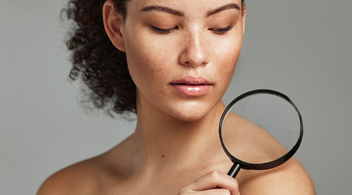 Pigmentflecken So wirken Sie Altersflecken und Co entgegen
